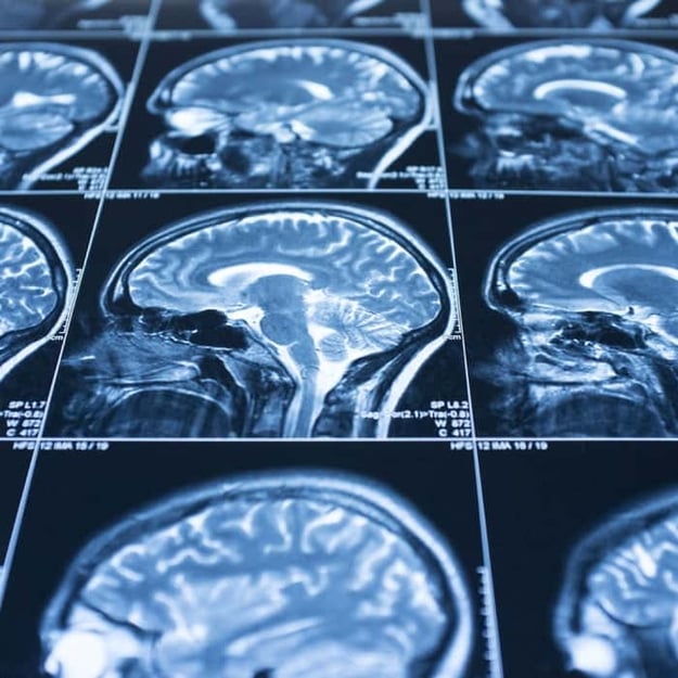 What is COE for Manufacturing Production Scheduling? | On Time Edge